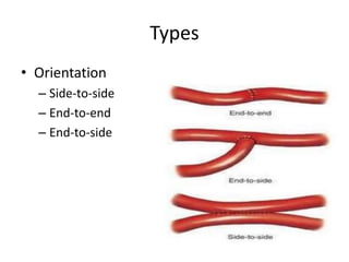 Principles of bowel anastomosis | PPTX