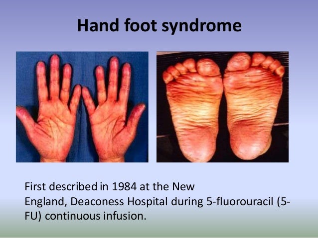 Principles of cancer chemotherapy and its clinical evaluation