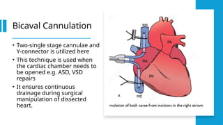 Principles of Cardiopulmonary Bypass.pptx