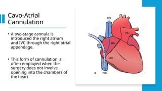 Principles of Cardiopulmonary Bypass.pptx
