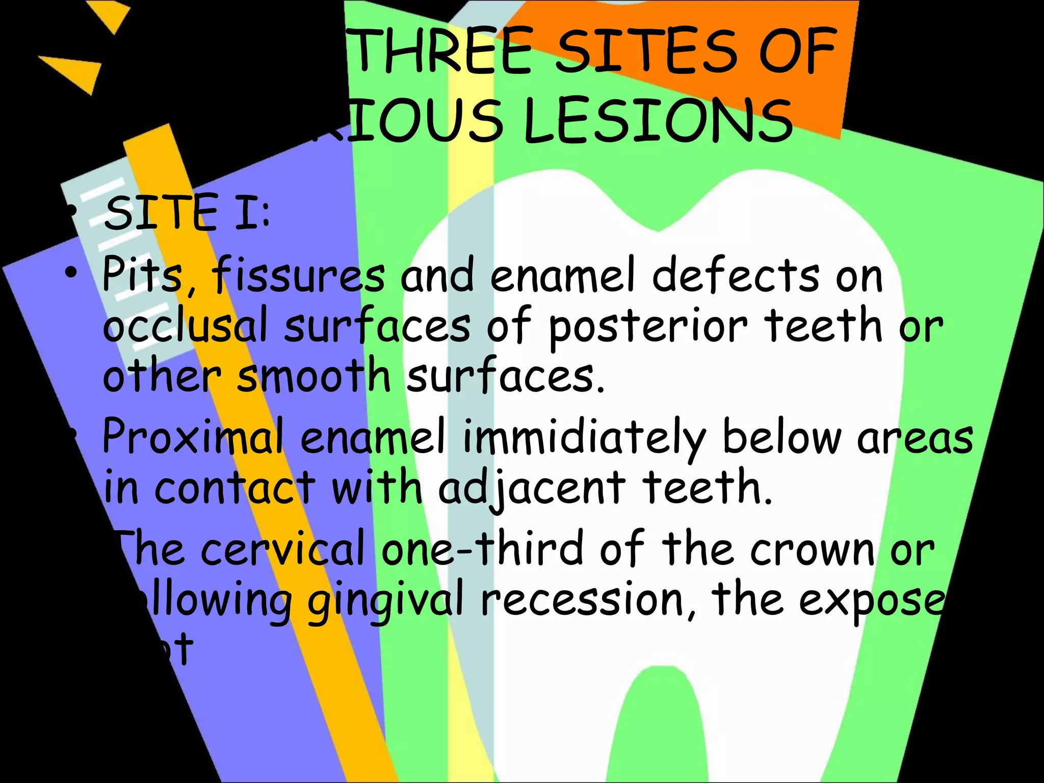 Principles and concepts of cavity preparation | PPT
