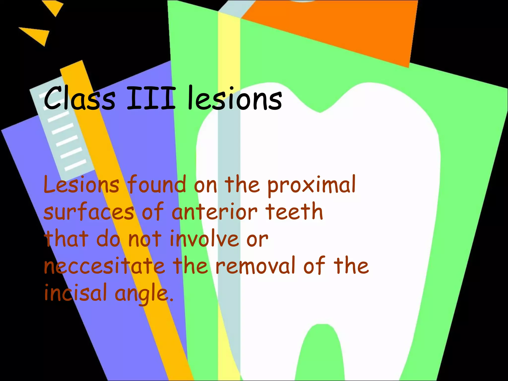Principles and concepts of cavity preparation | PPT