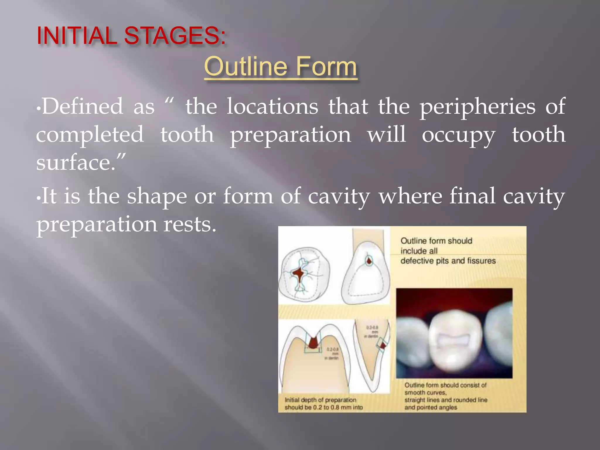Principles of cavity preparation | PPTX