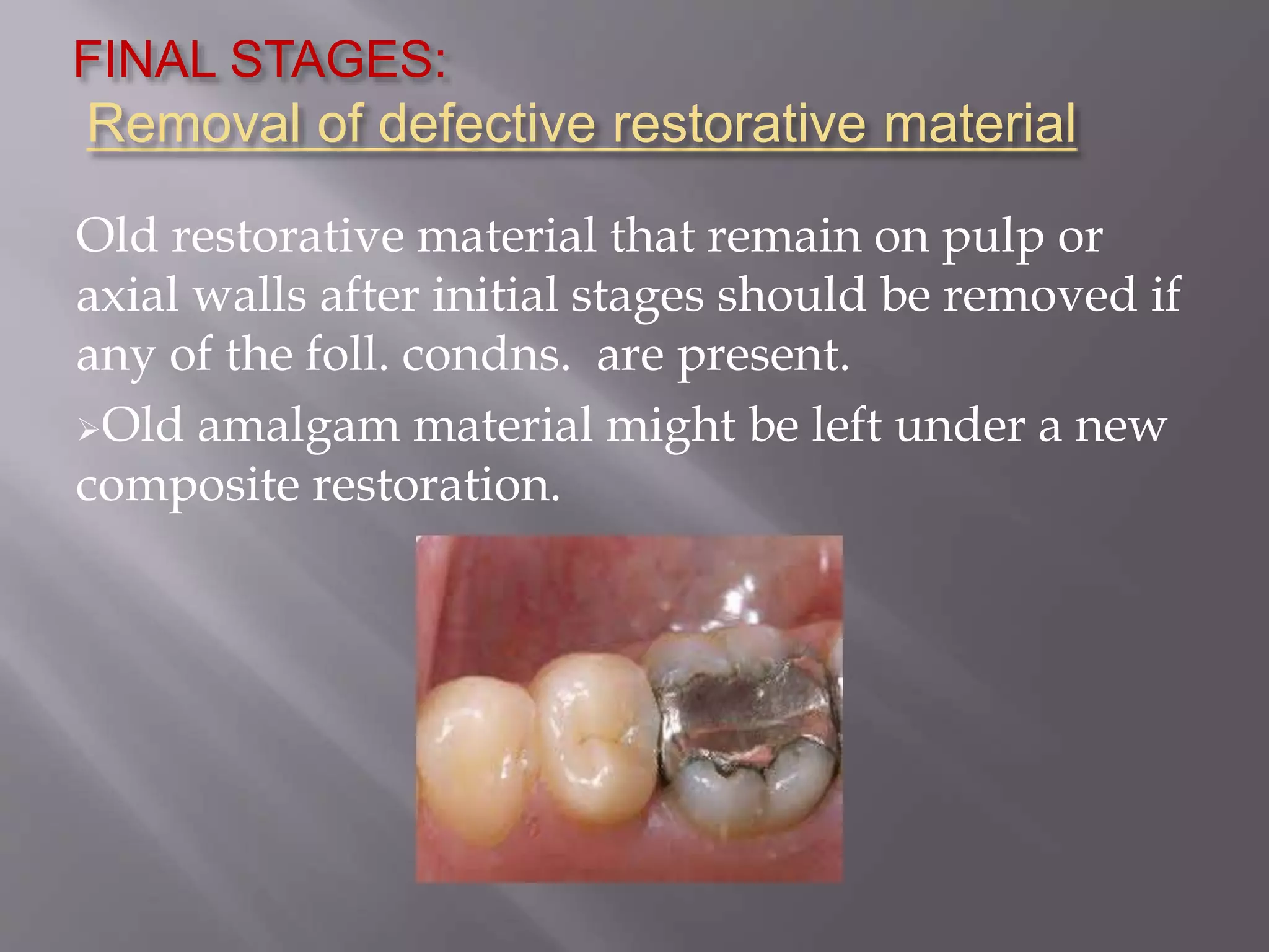 Principles of cavity preparation | PPTX