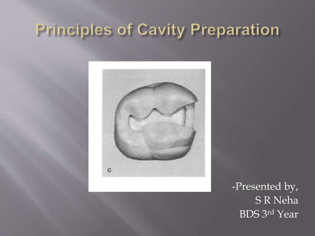 Principles of cavity preparation | PPTX | Dental Health | Diseases and ...