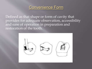 Principles of cavity preparation | PPTX