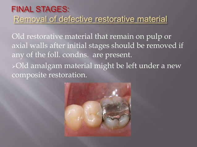 Principles of cavity preparation | PPT
