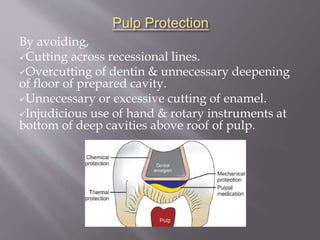 Principles of cavity preparation | PPTX