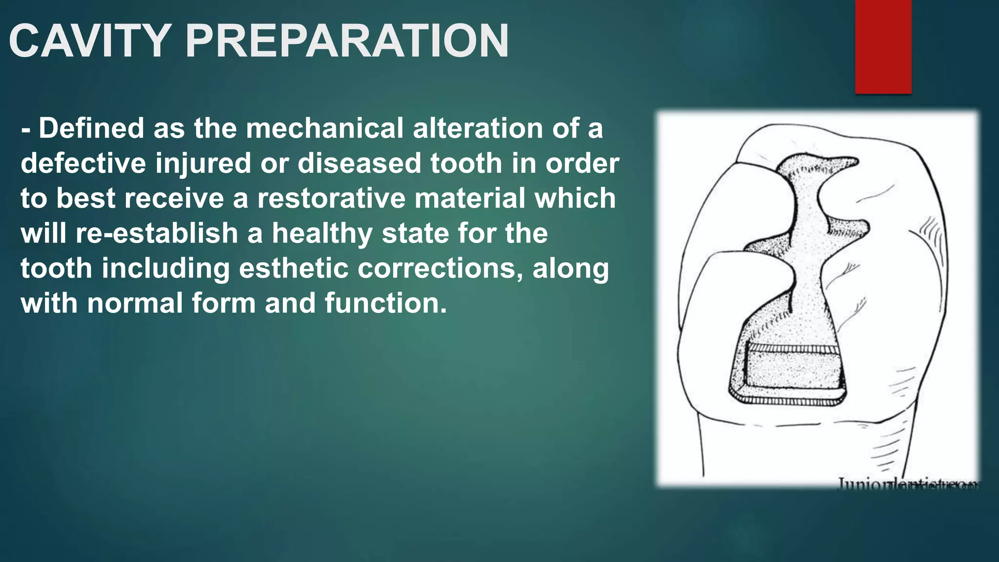 Principles_of_cavity_preparation_accordi.ppsx