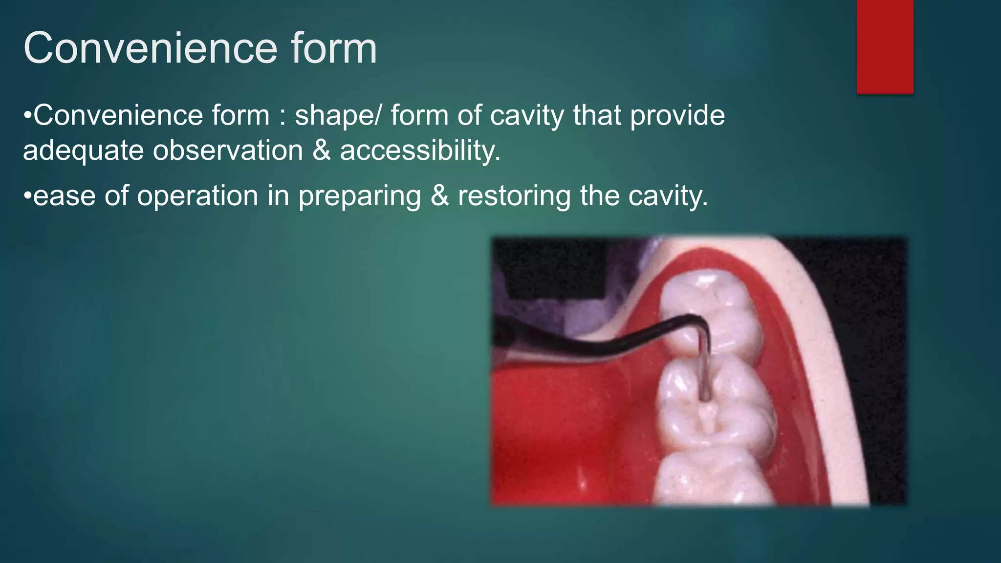 Principles_of_cavity_preparation_accordi.ppsx