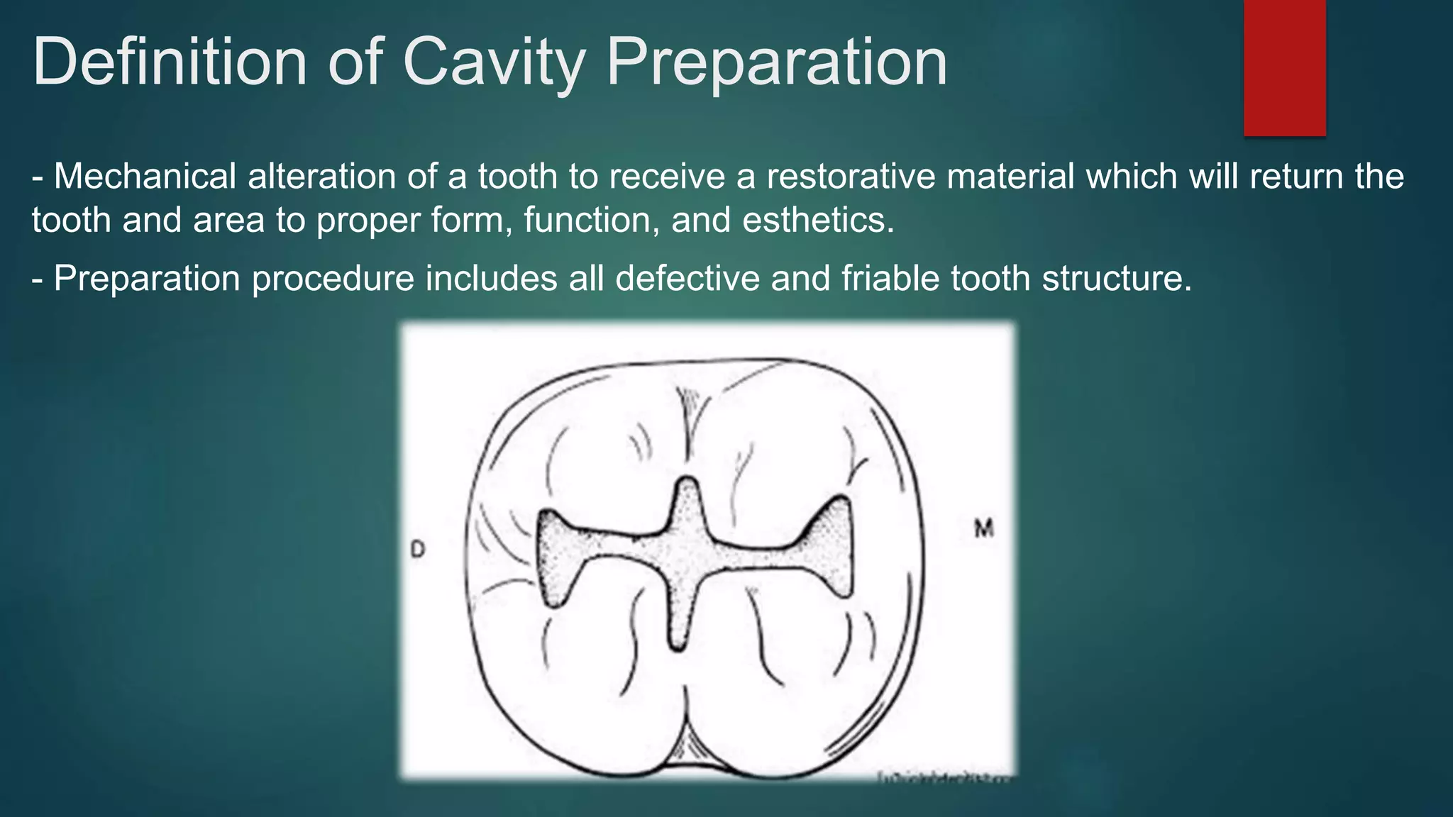Principles_of_cavity_preparation_accordi.ppsx
