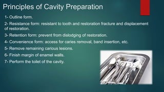 Principles_of_cavity_preparation_accordi.ppsx