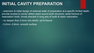 Principles_of_cavity_preparation_accordi.ppsx