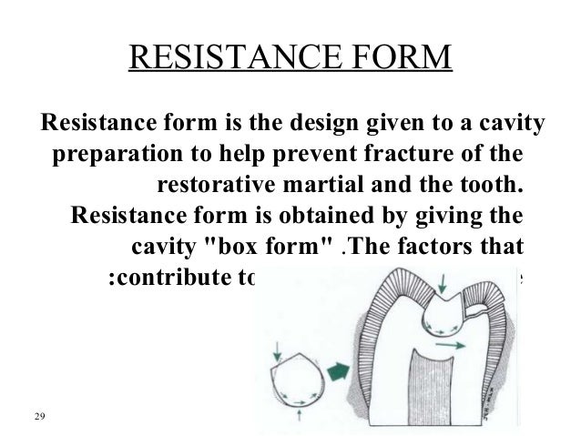 Principles of cavity preparations