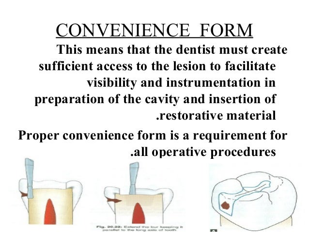 Principles of cavity preparations