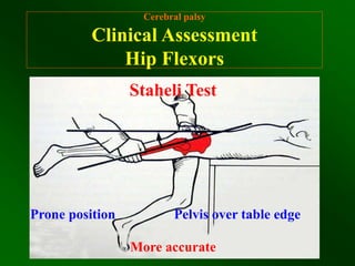 Principles of cerebral palsy | PPT
