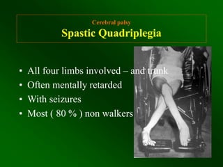 Principles of cerebral palsy | PPT