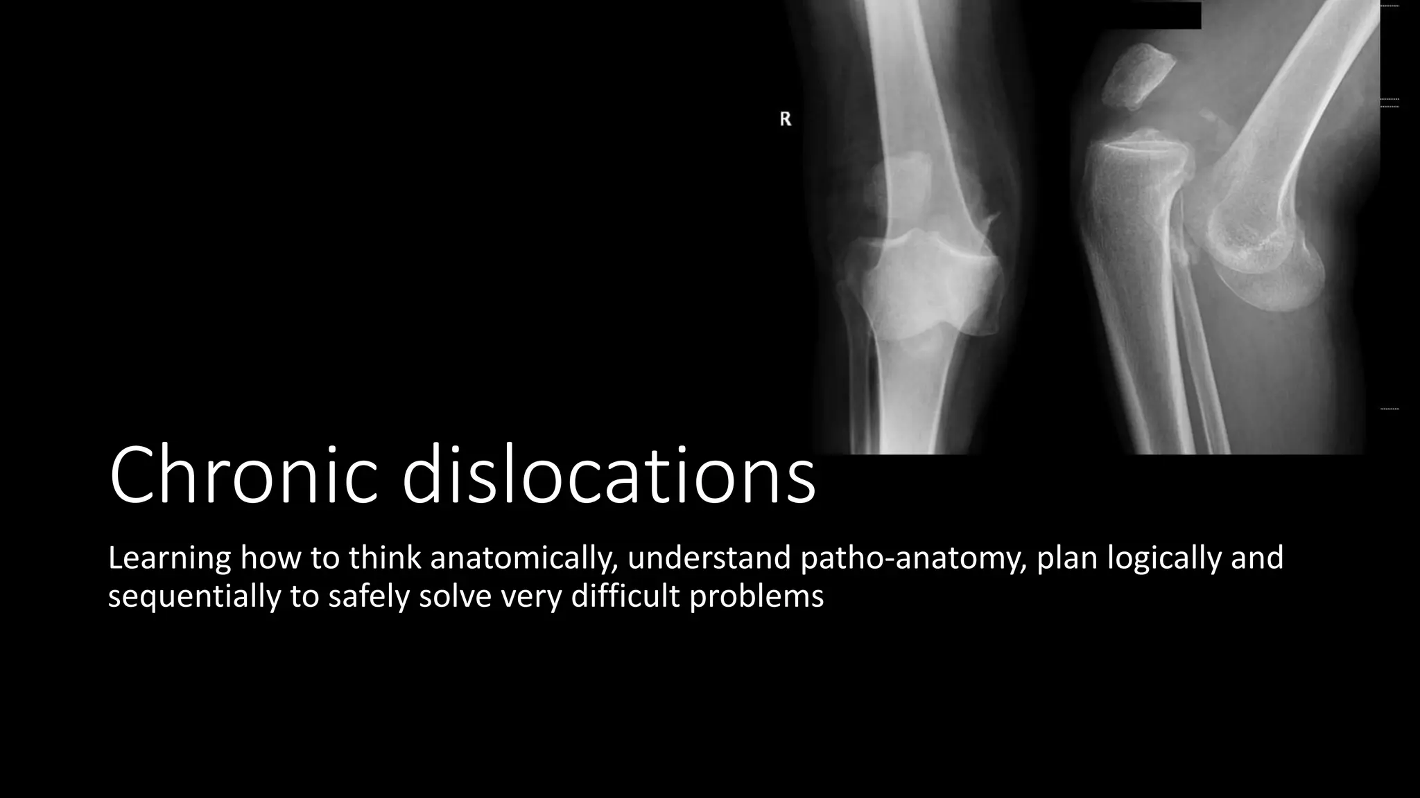 1principles of Chronic dislocations.pptx