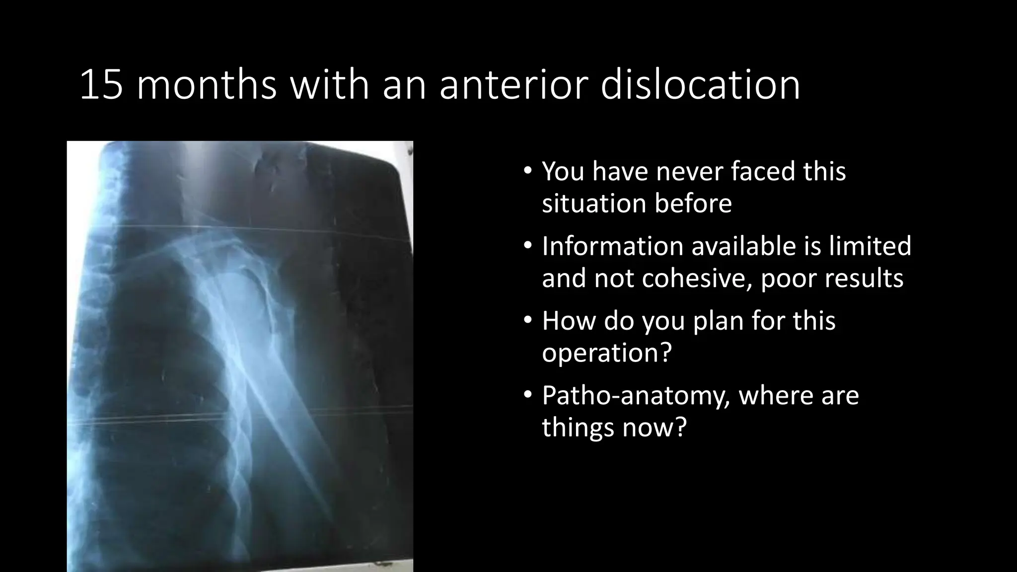 1principles of Chronic dislocations.pptx