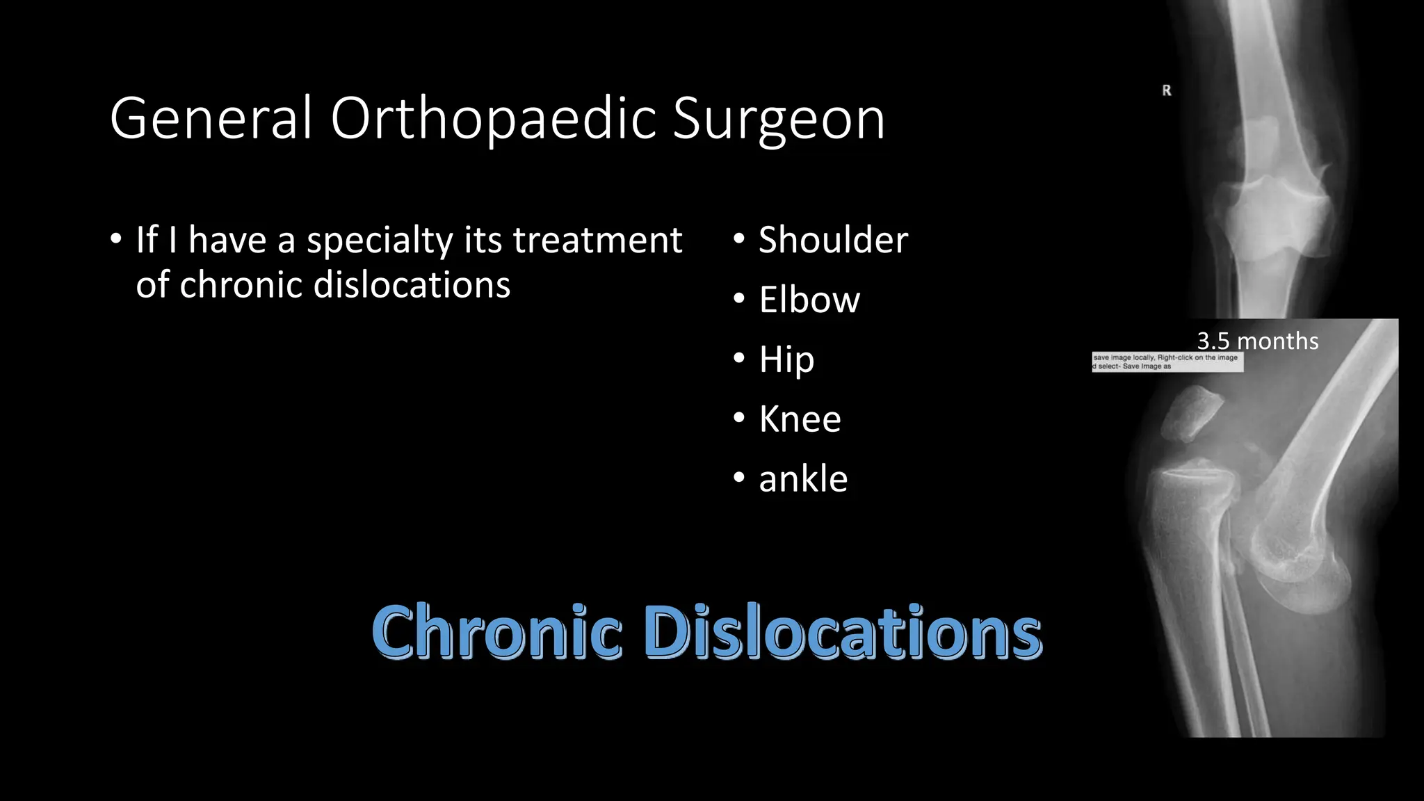 1principles of Chronic dislocations.pptx