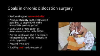 1principles of Chronic dislocations.pptx