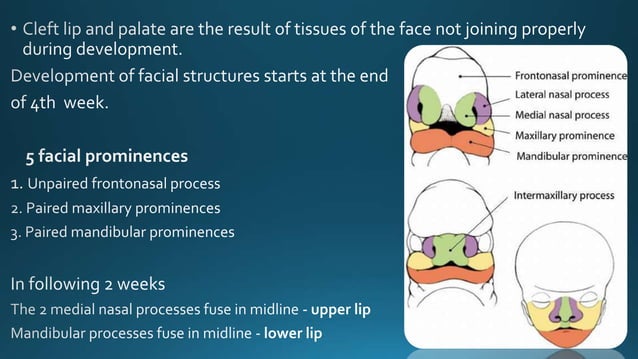 Principles of cleft lip and palate formation | PPT