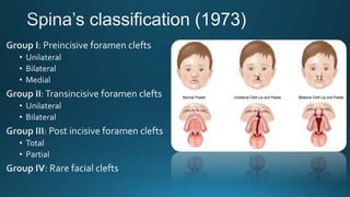 Principles of cleft lip and palate formation | PPTX