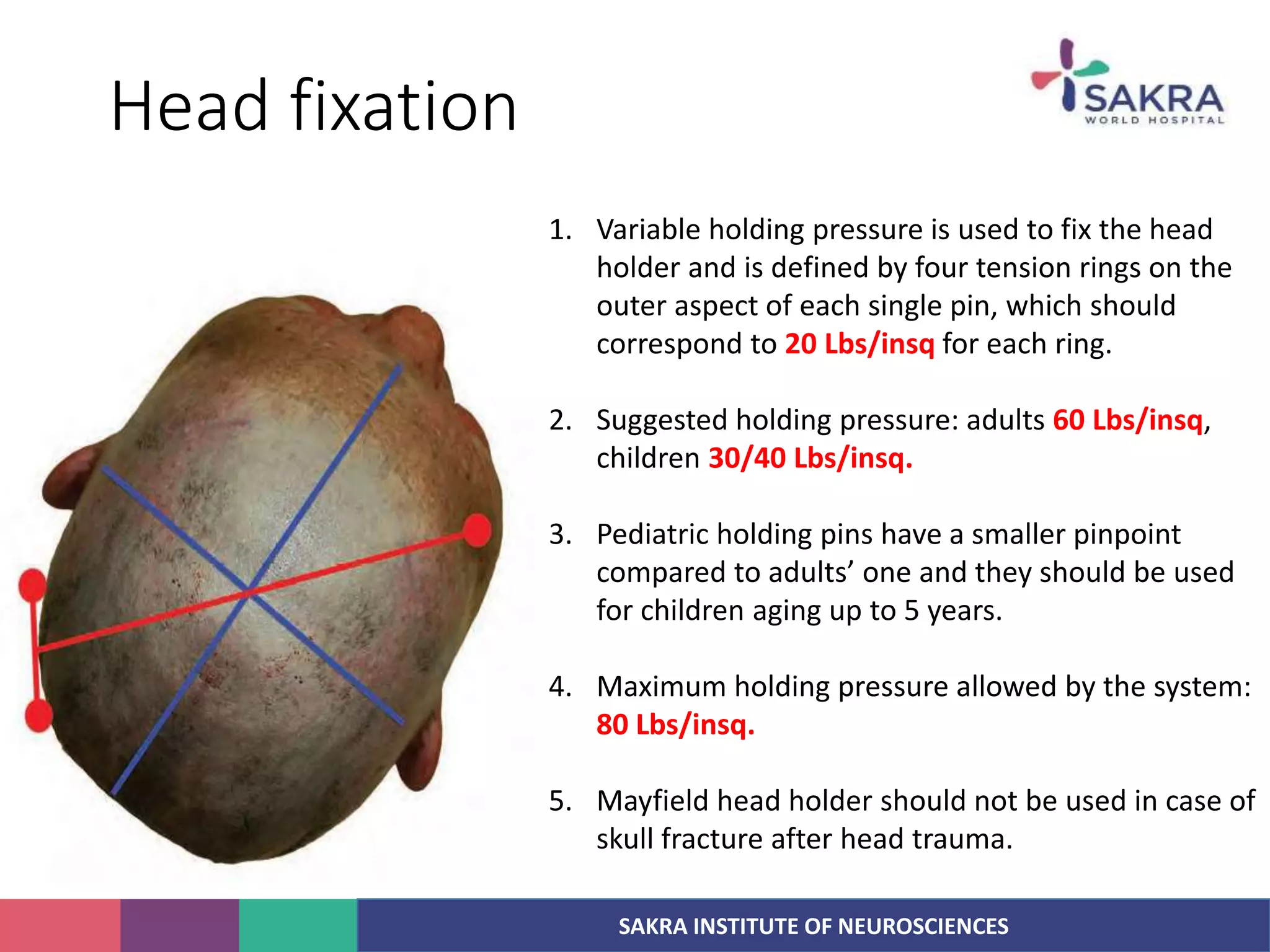 Principles of craniotomy flaps | PPTX