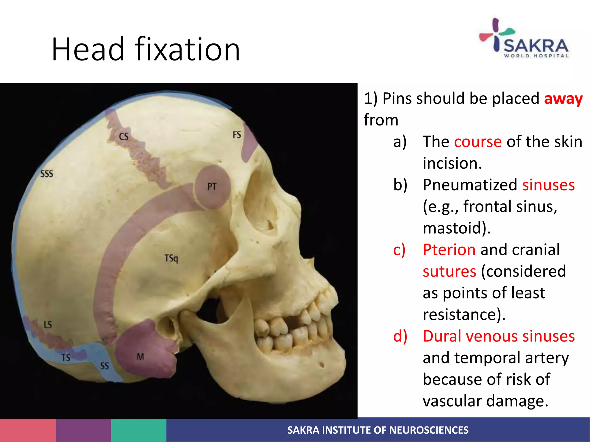Principles of craniotomy flaps | PPTX