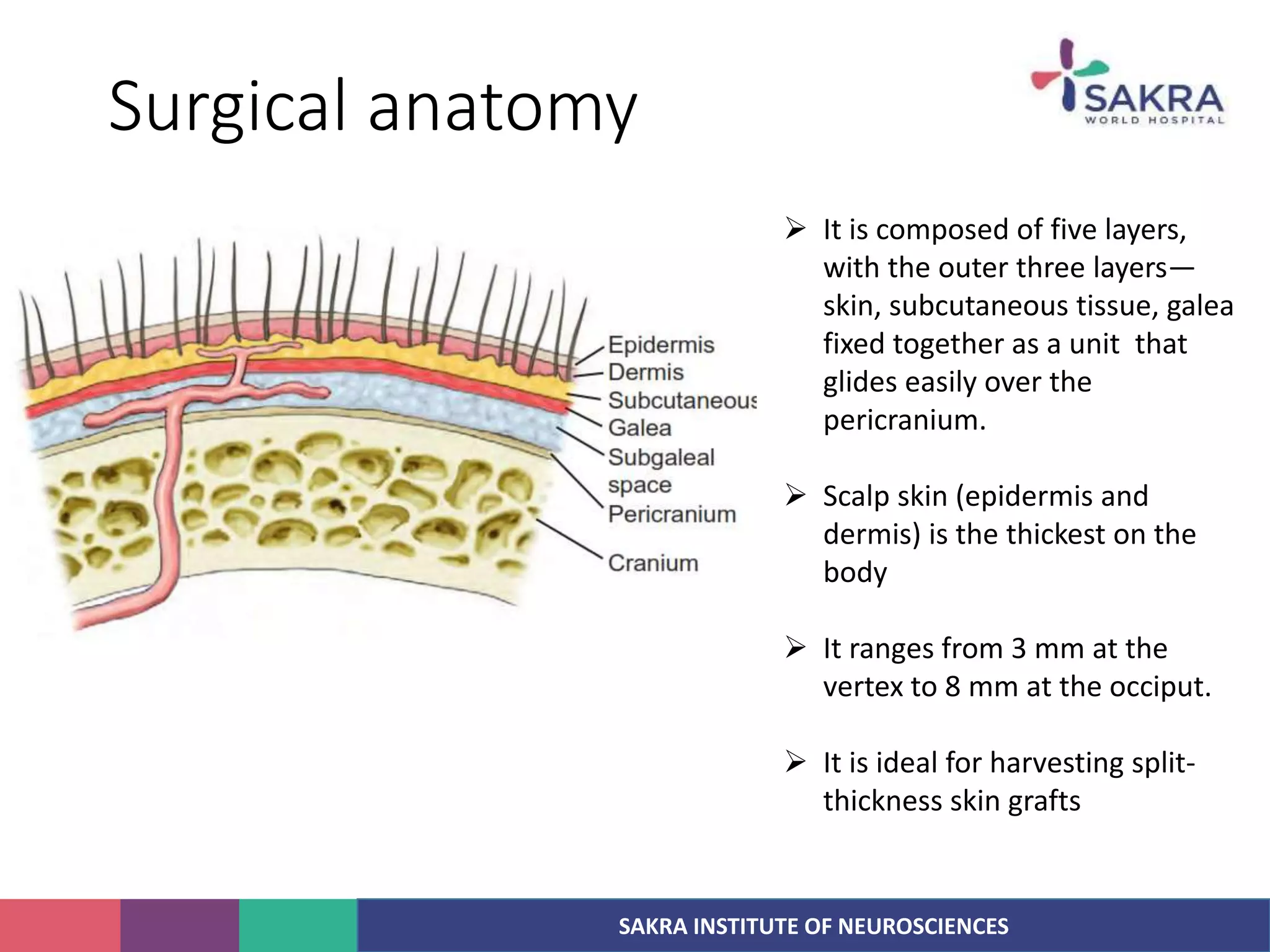 Principles of craniotomy flaps | PPTX