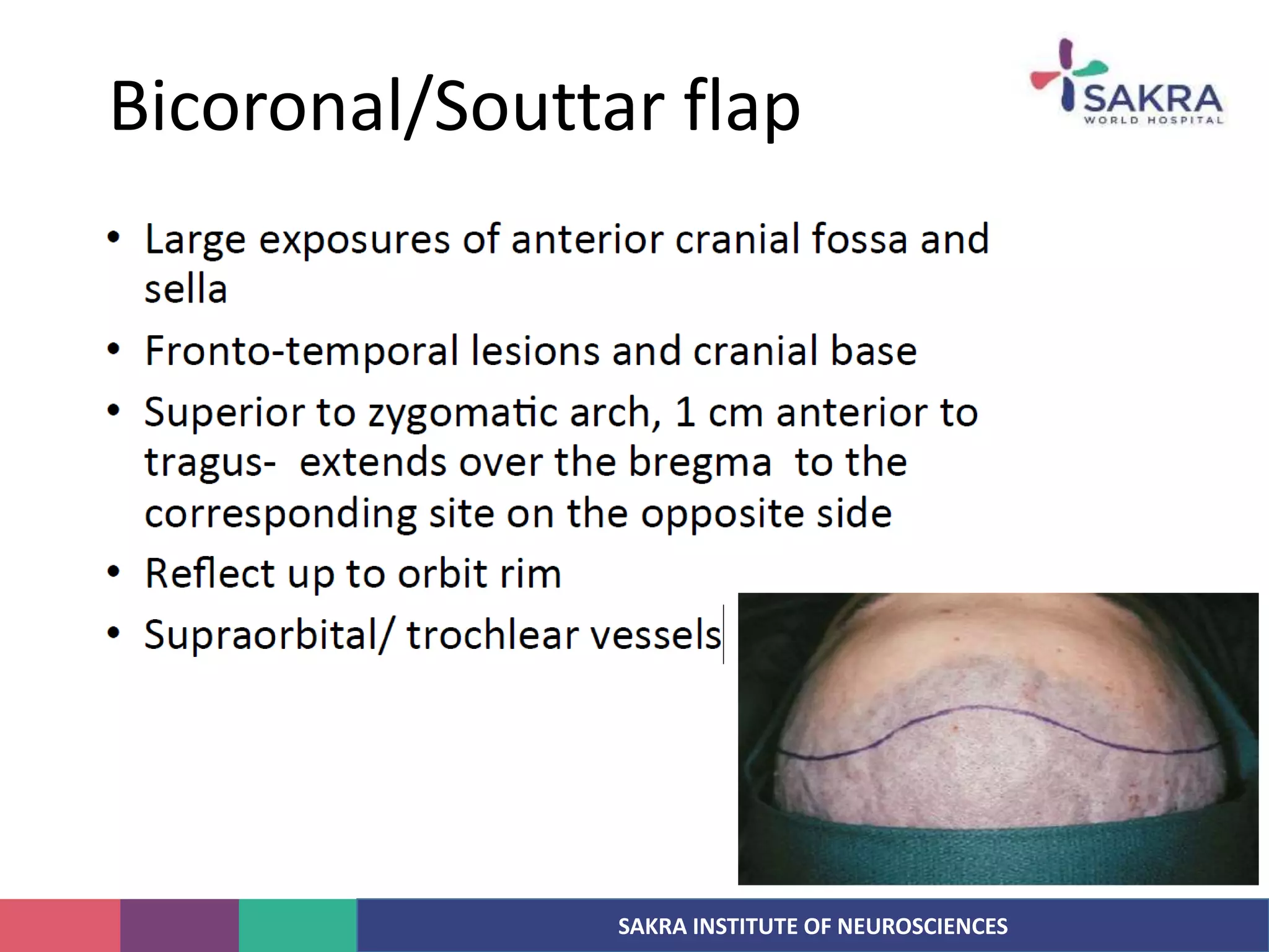 Principles of craniotomy flaps | PPTX