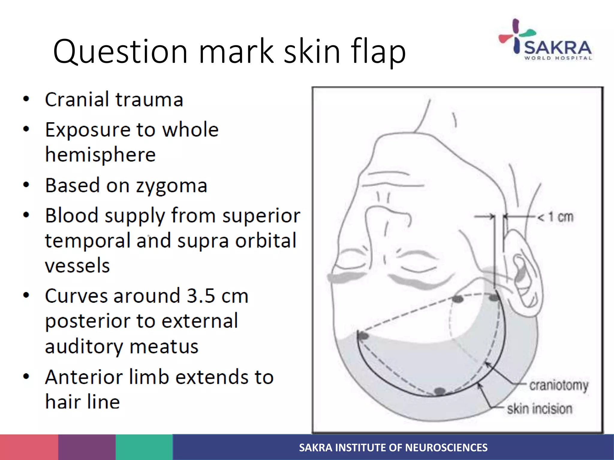 Principles of craniotomy flaps | PPTX