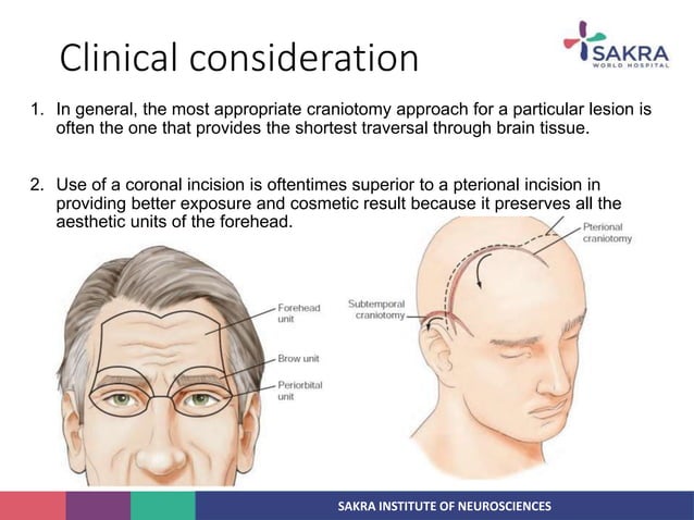 Principles of craniotomy flaps | PPTX