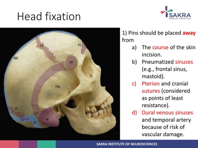 Principles of craniotomy flaps | PPTX