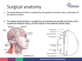 Principles of craniotomy flaps | PPTX