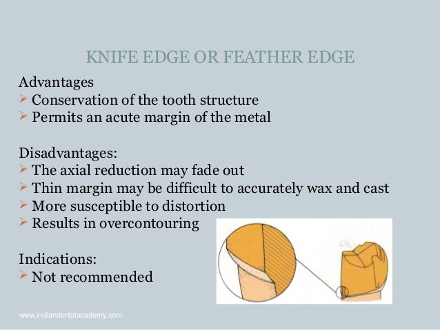 Principles of crown preparation/ orthodontic seminars