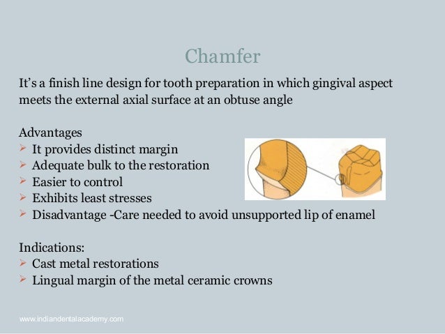 Principles of crown preparation/ orthodontic seminars