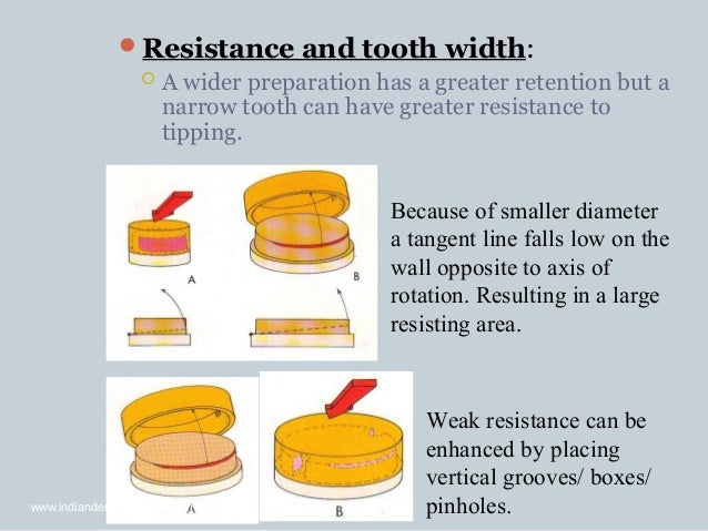 Principles of crown preparation/ orthodontic seminars