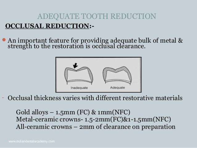 Principles of crown preparation/ orthodontic seminars