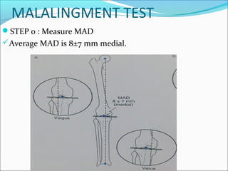 Principles of deformity correction | PPT