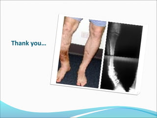Principles of deformity correction | PPT