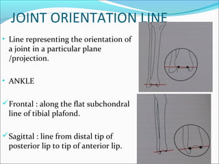 Principles of deformity correction | PPT