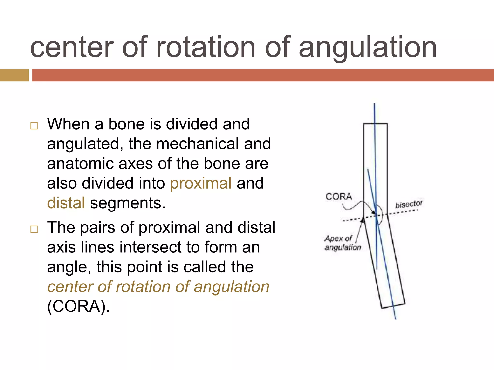 Principles of deformity correction | PPTX