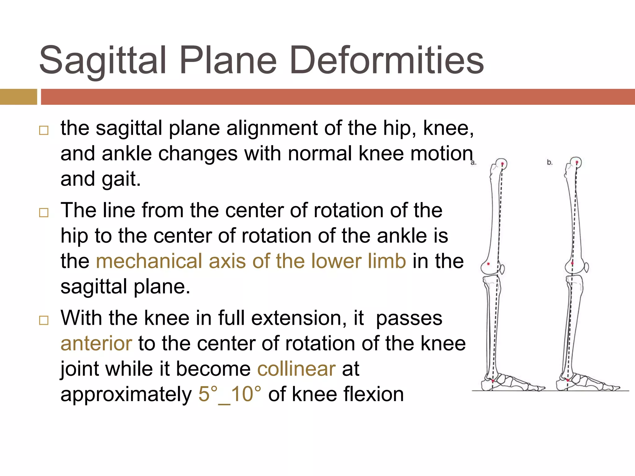 Principles of deformity correction | PPTX