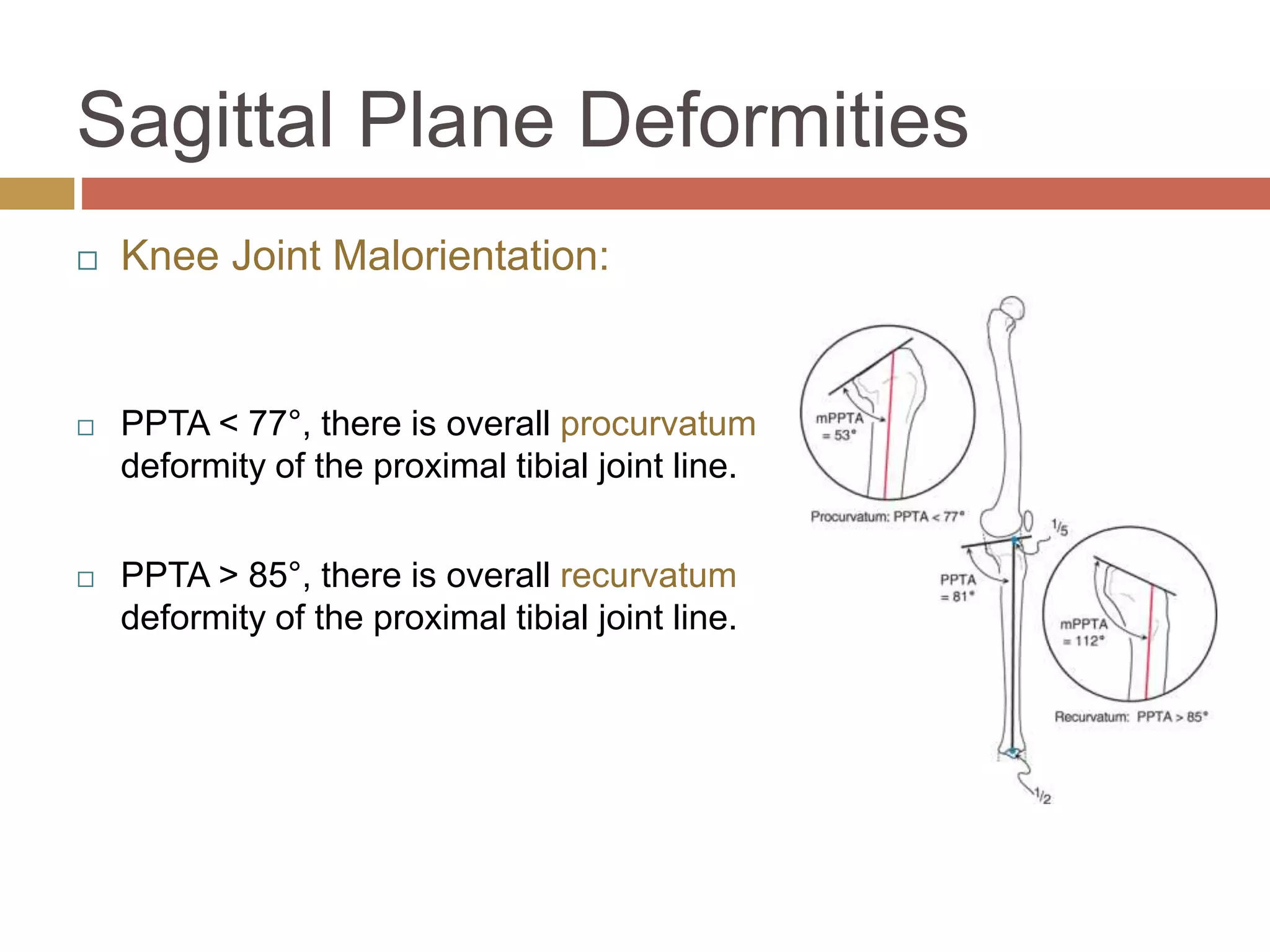 Principles of deformity correction | PPTX