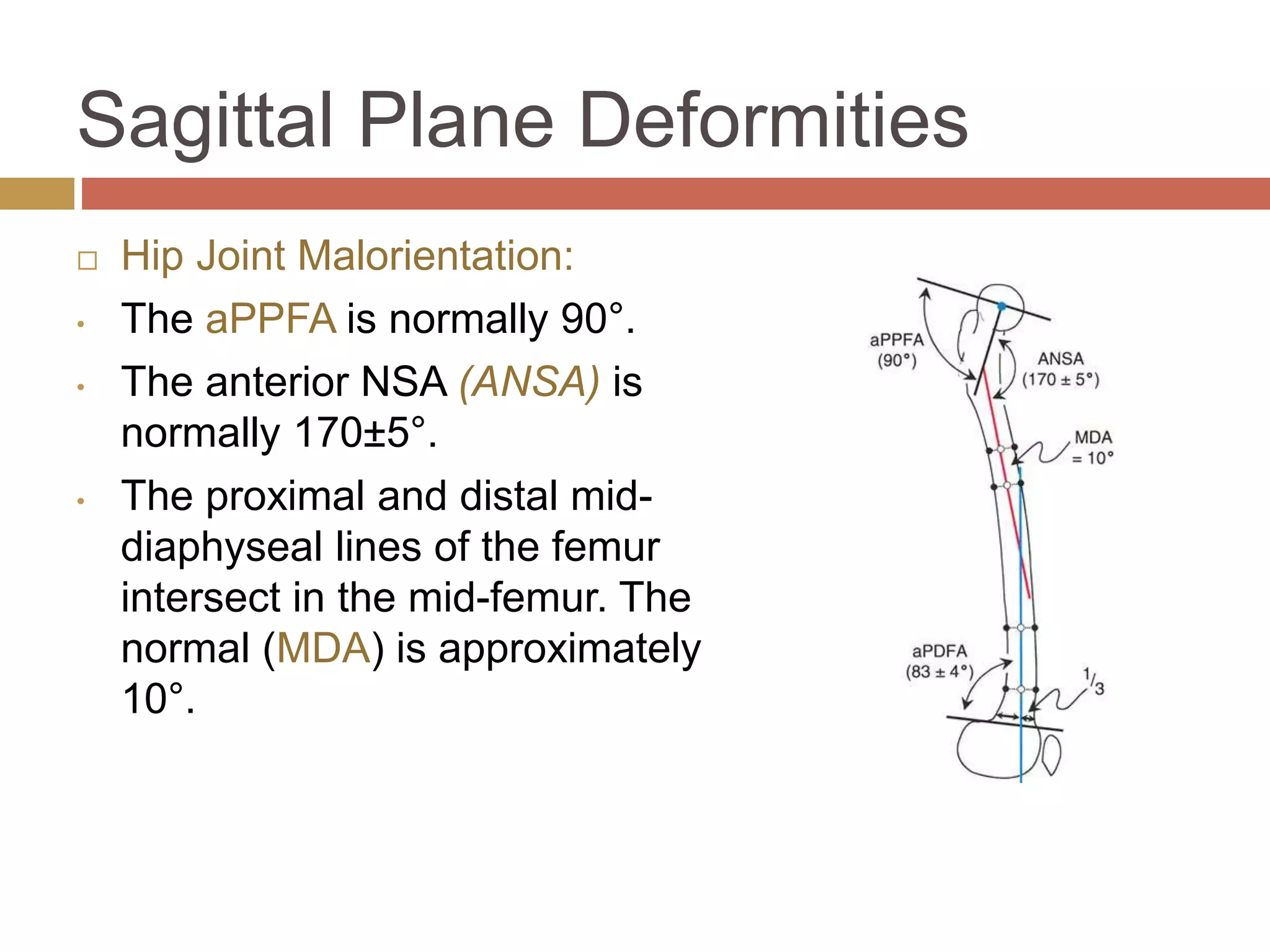Principles of deformity correction | PPTX
