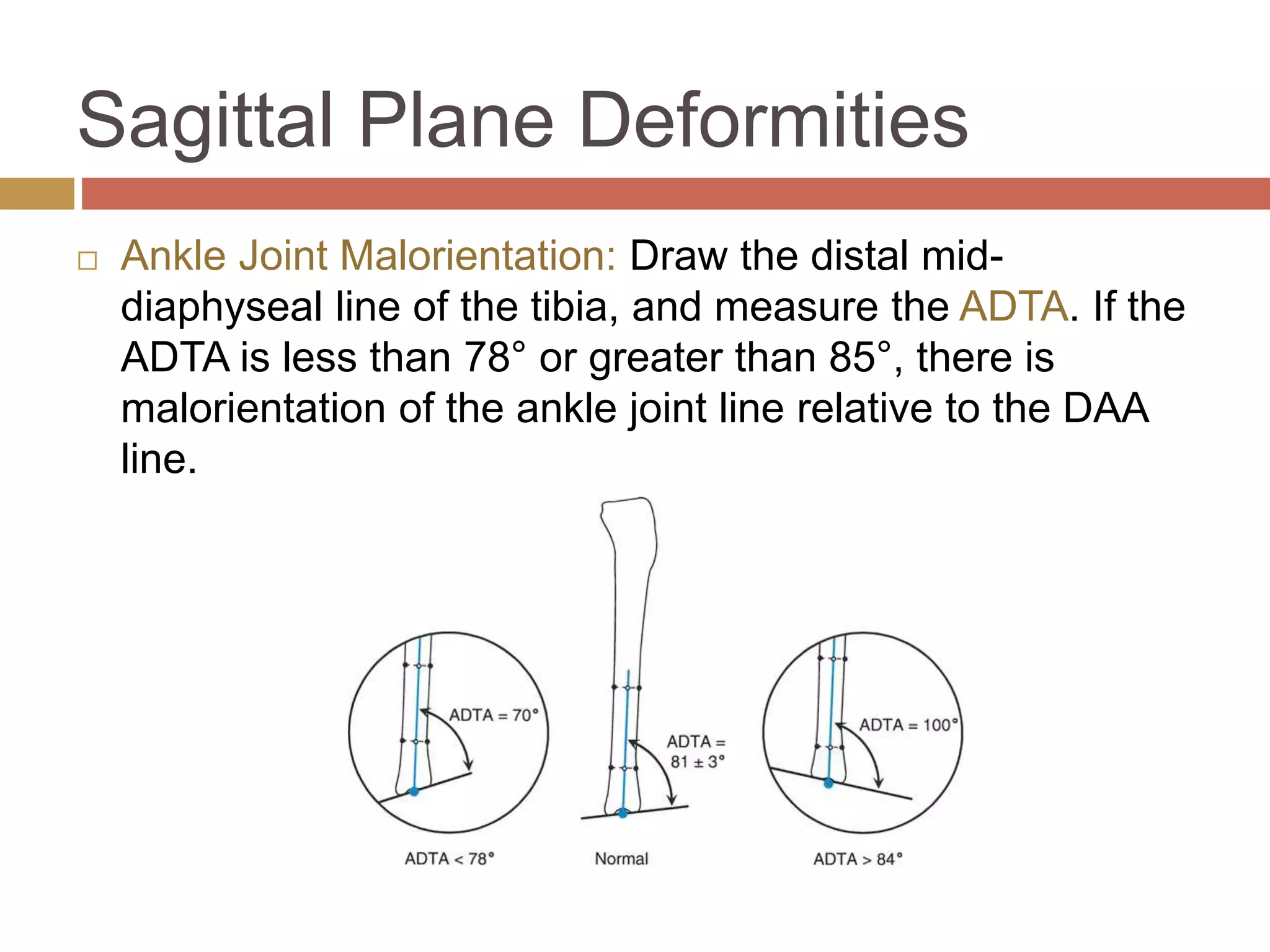 Principles of deformity correction | PPTX