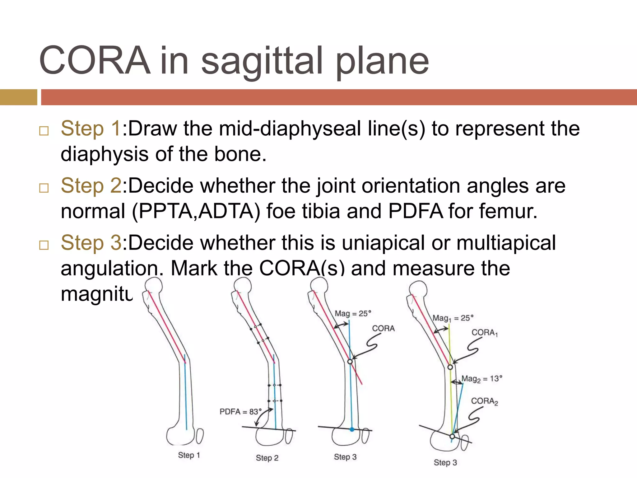 Principles of deformity correction | PPTX
