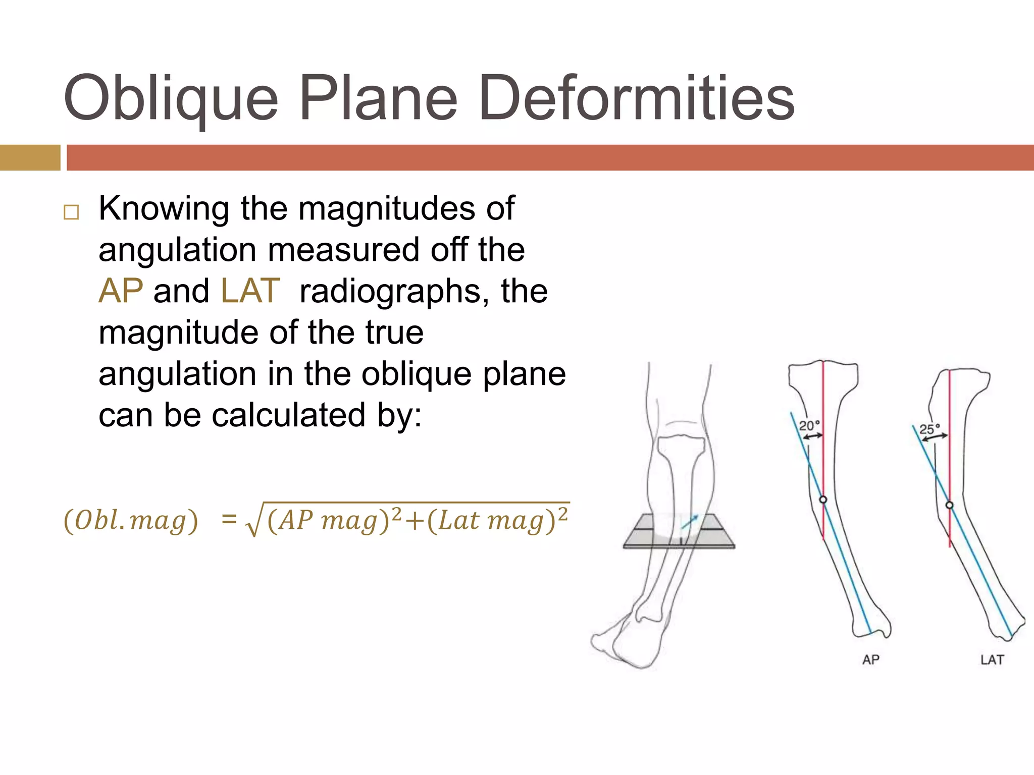 Principles of deformity correction | PPTX