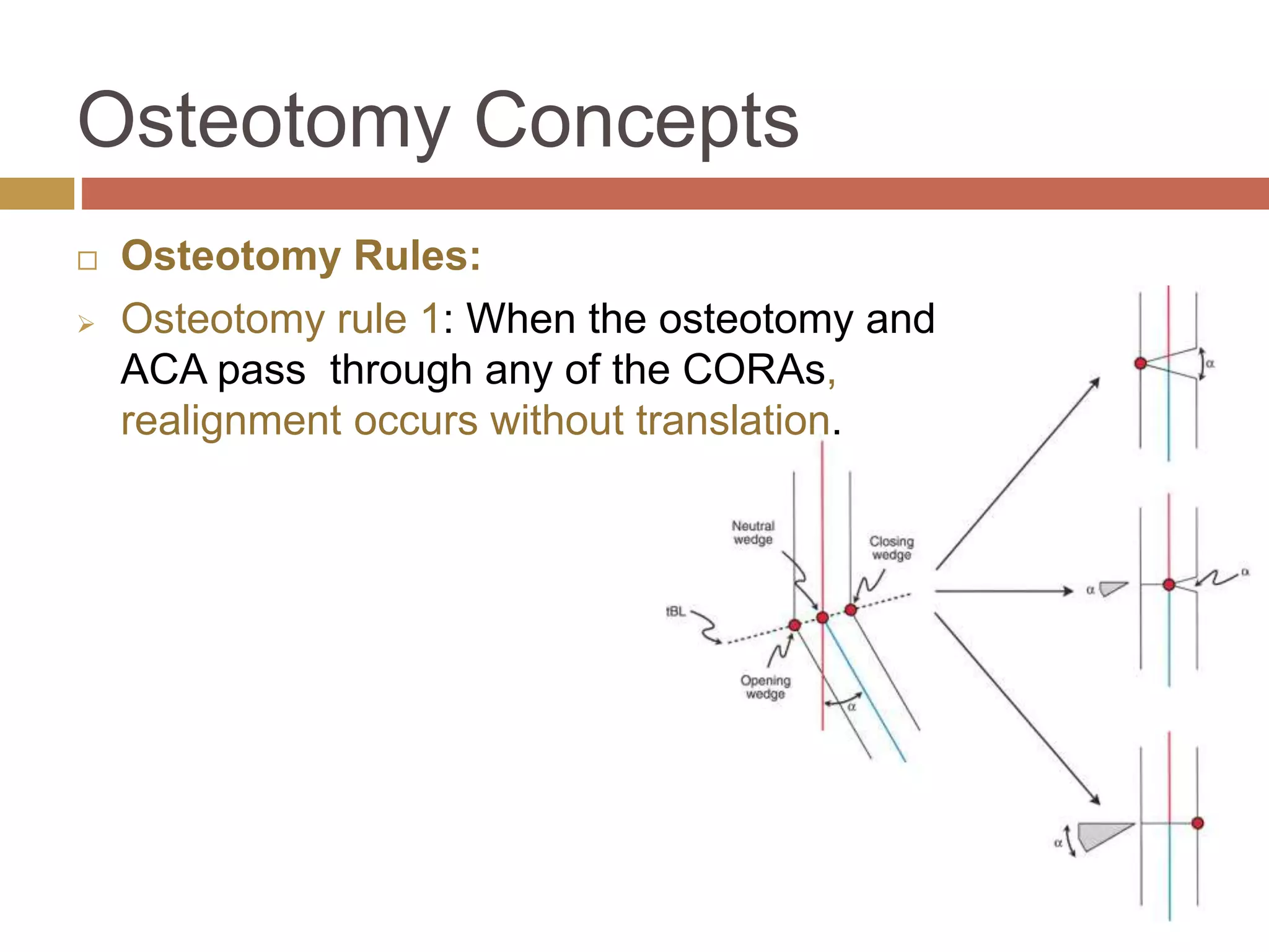 Principles of deformity correction | PPTX